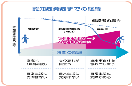 新オプション MCIスクリーニング検査プラス(軽度認知障害）